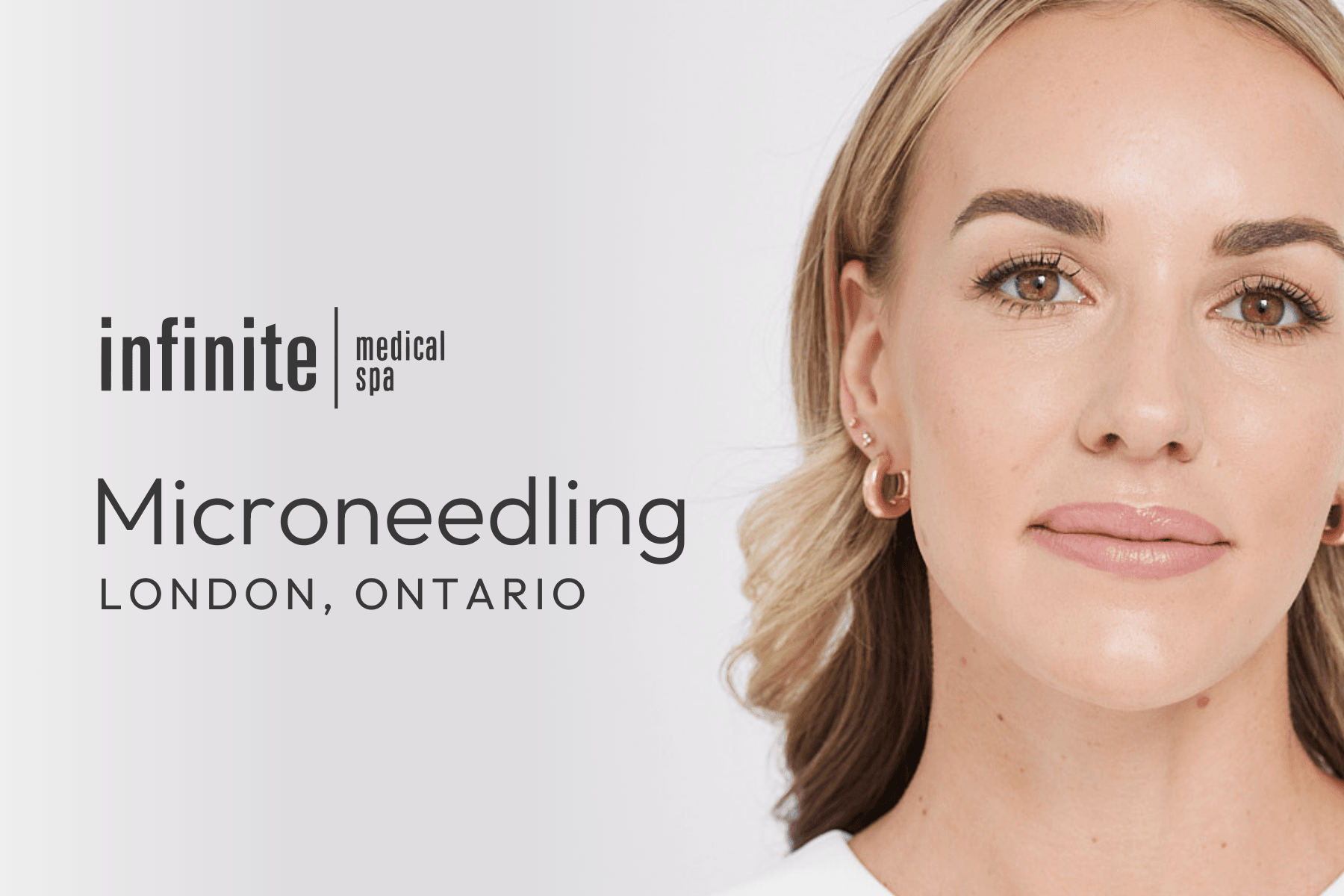 Microneedling Treatment London Ontario - Infinite Medical Spa
